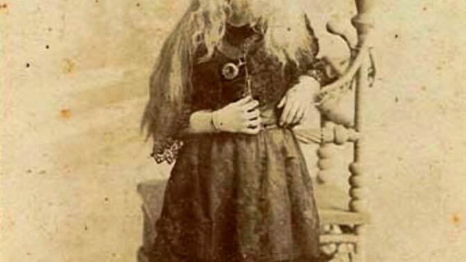 Galerie: Vlčí dívka Alice Doherty: Jako hříčku přírody ji za peníze ...