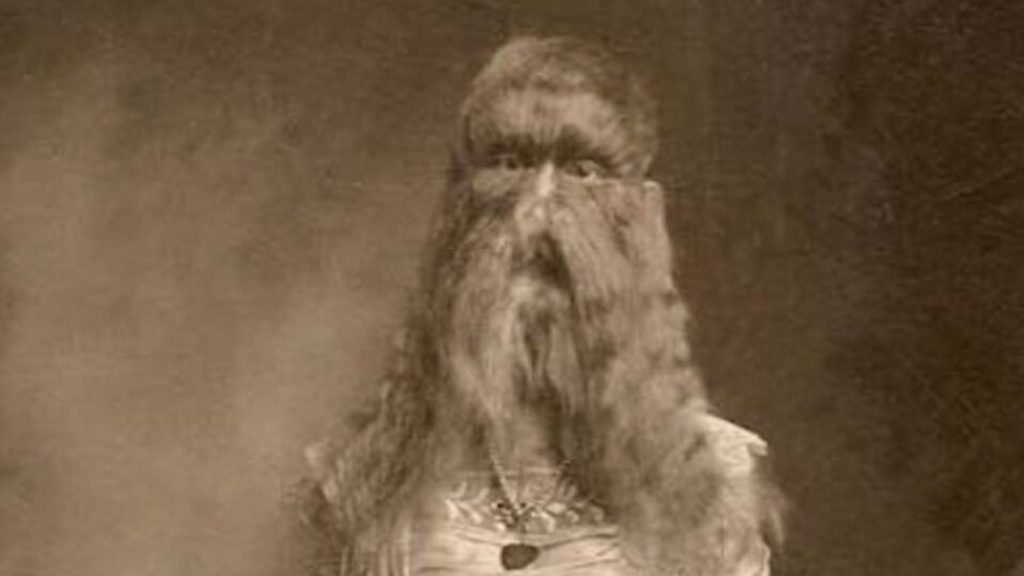 Vlčí dívka Alice Doherty: Jako hříčku přírody ji za peníze předváděli ...