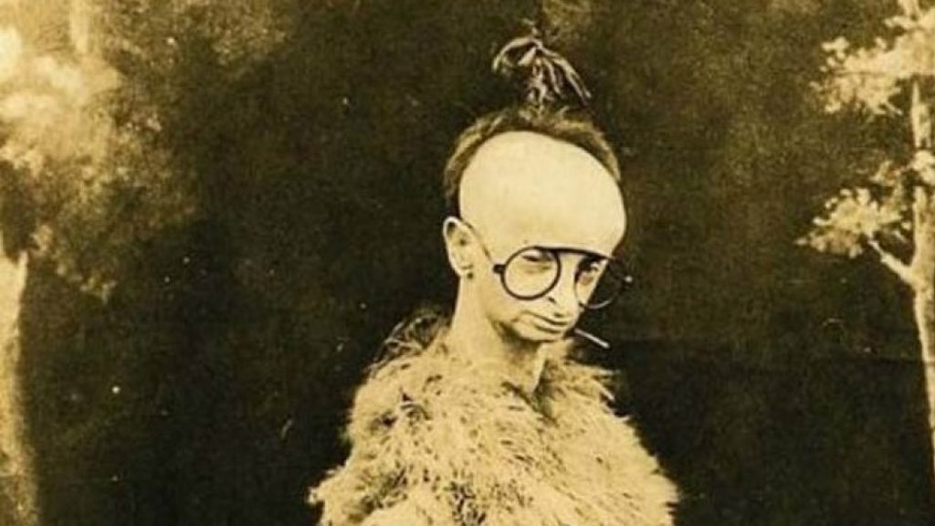 Ošklivá hvězda cirkusu: Ptačí dívka trpěla Seckelovým syndromem