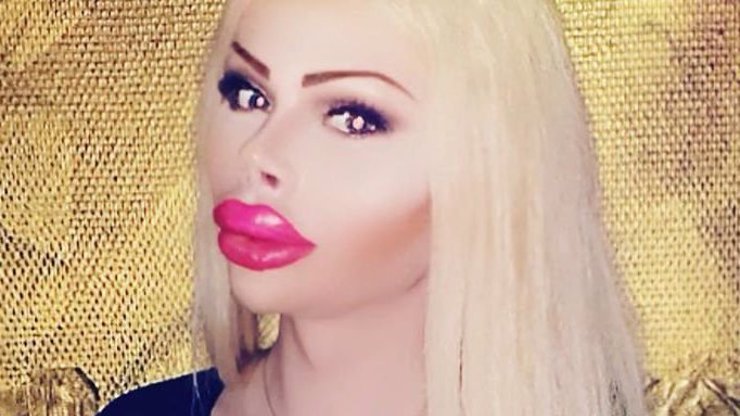 Patrick Mast – nejnovější zprávy a fotografie – eXtra.cz